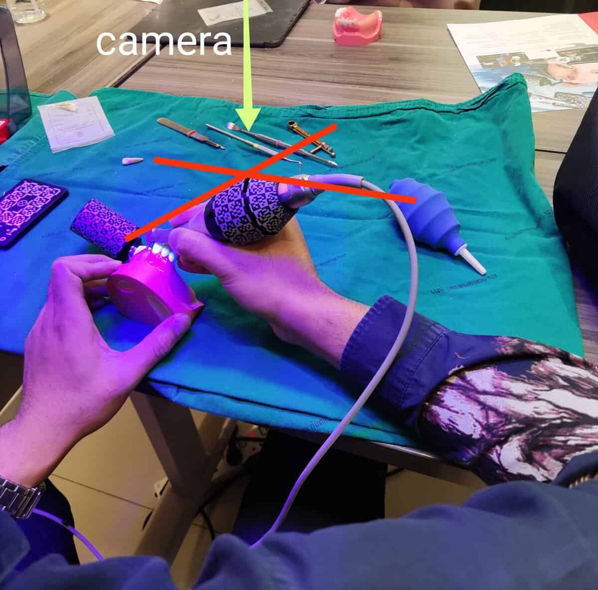 Computer Assisted Implant Surgery in Clinical Practice! – Implant ...