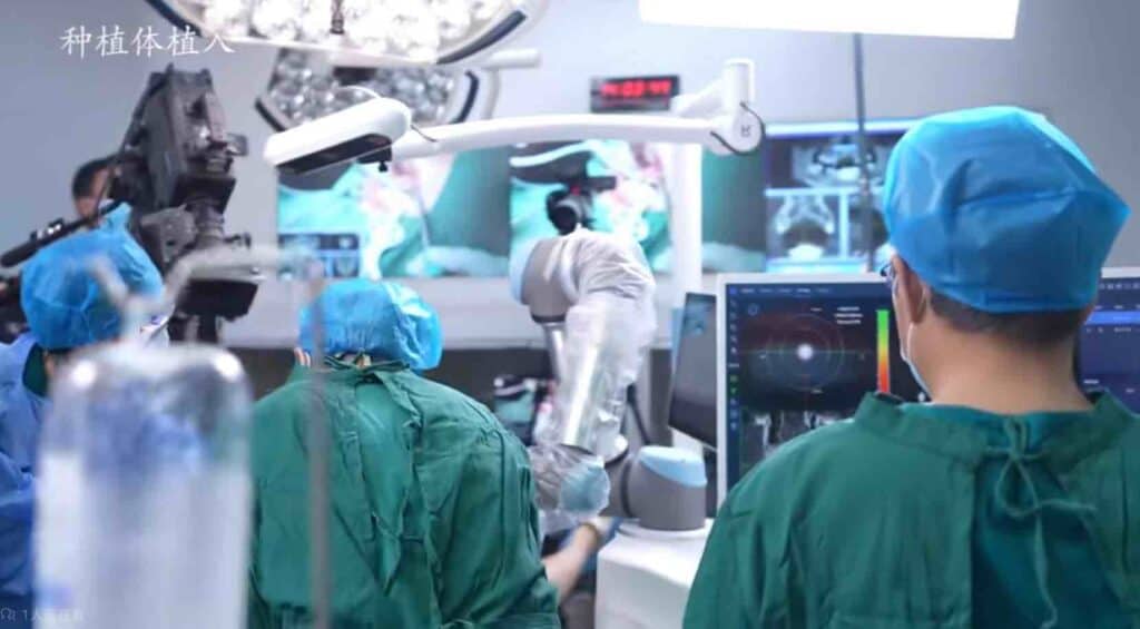 Tissue level Bone Level implants – Implant + Dentistry – Nikos Mattheos