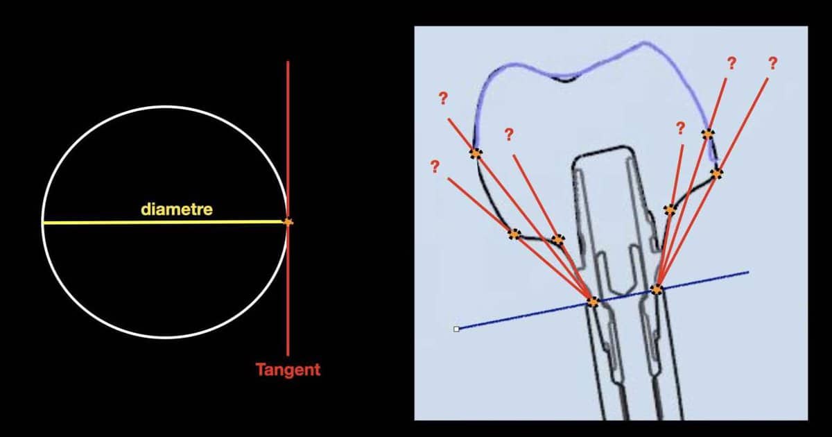 Implant Emergence Profile Demystified – Implant + Dentistry – Nikos ...