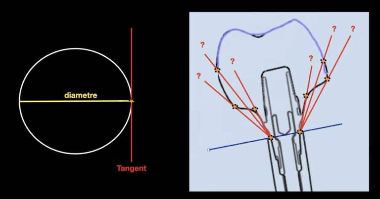 Implant Emergence Profile Demystified – Implant + Dentistry – Nikos ...