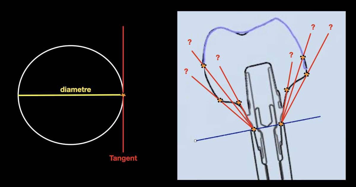 Implant Emergence Profile Demystified – Implant + Dentistry – Nikos Mattheos