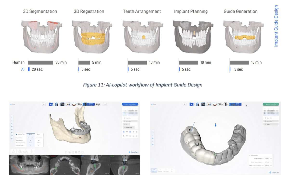 Precision Implant Dentistry? – Implant + Dentistry – Nikos Mattheos